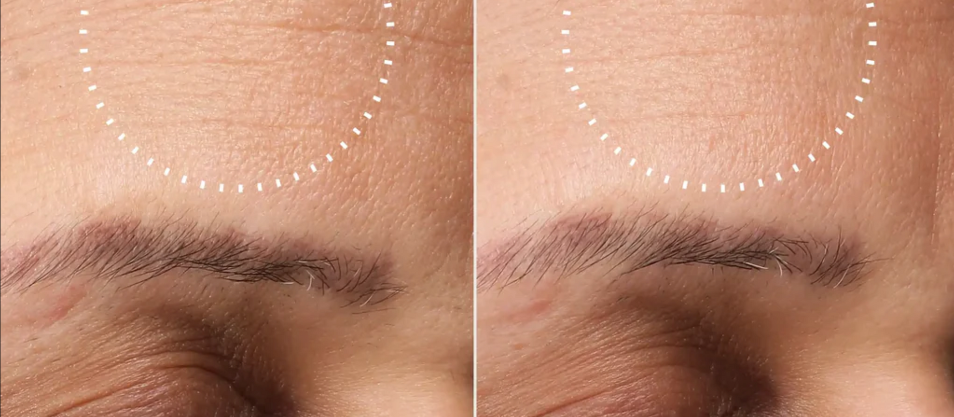 Ácido Glicólico: El secreto de una piel radiante y joven con Medik8 – Medik8 España