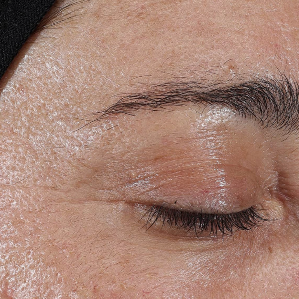 Crystal Retinal 20 de Medik8 | La Revolución en Sérums de Vitaminas A ...